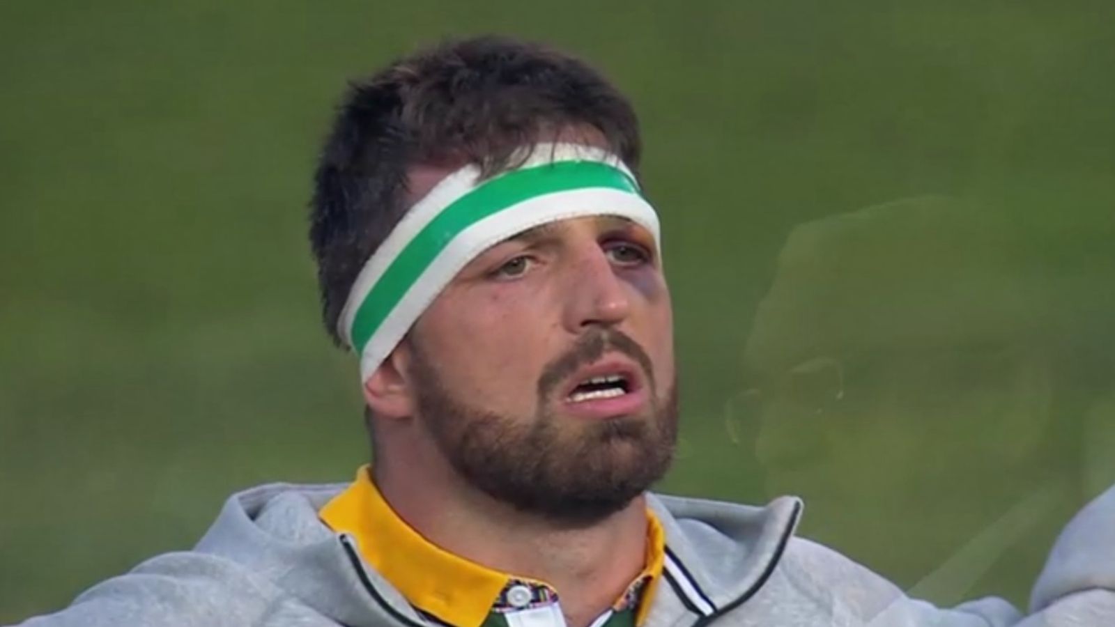 Jean Kleyn reveals how he got his black eye ahead of Springboks debut ...