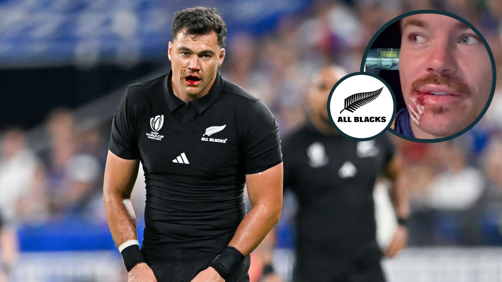 How tackling an All Black led to ghastly 60-stitch injury